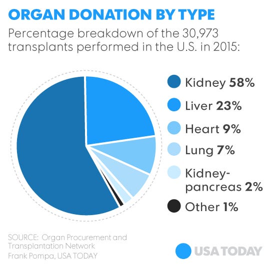 U.S. organ transplants reach 30K milestone, thanks to increased donations